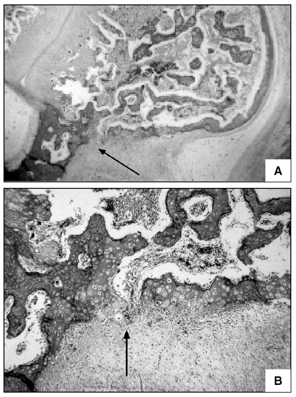 Conexiones entre la médula ósea de los osículos y el mesénquima del ...