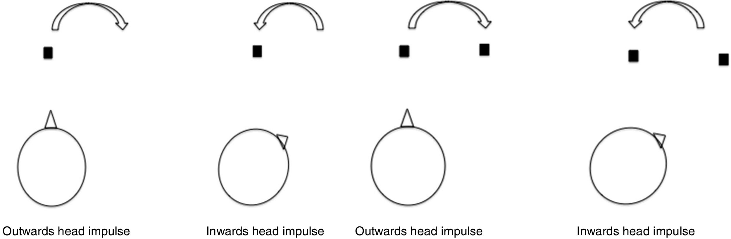 Effect of different head impulse procedures on vestibulo-ocular reflex ...