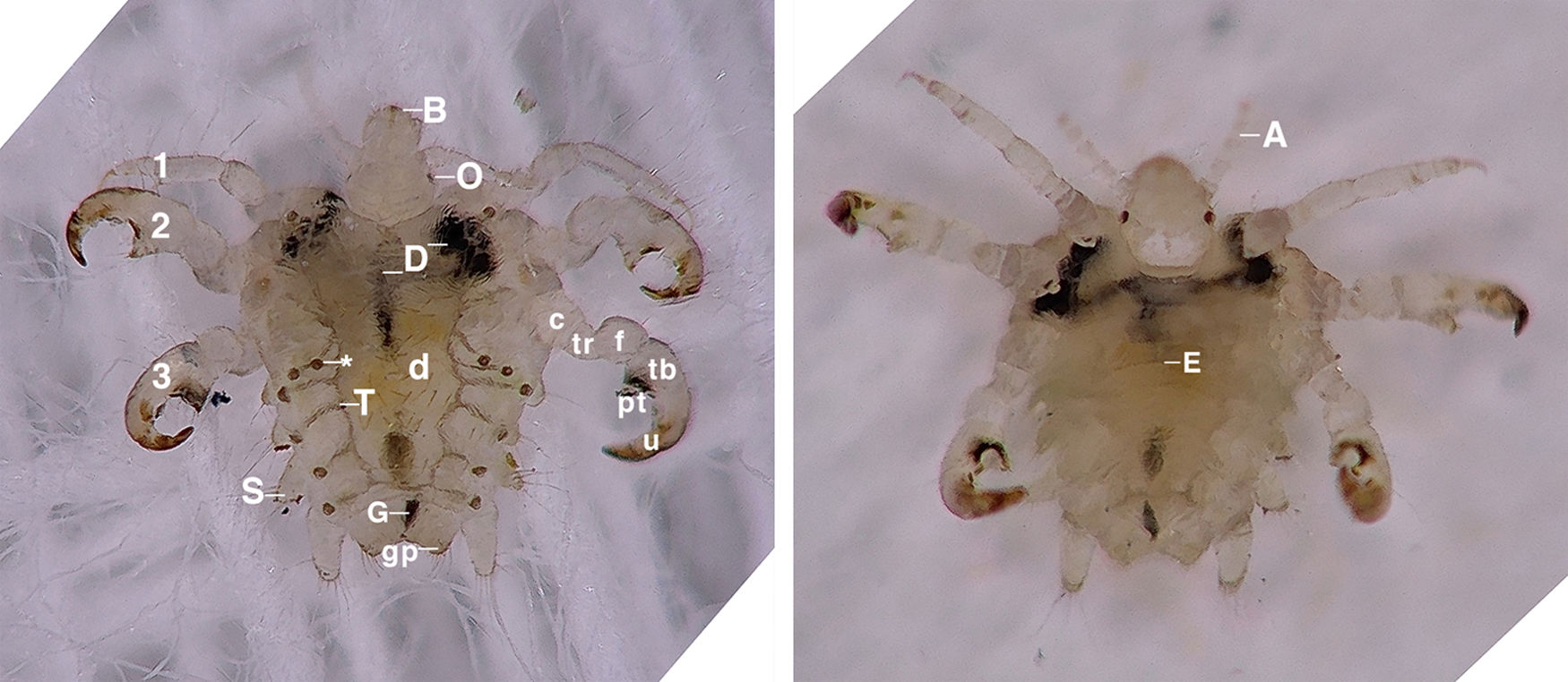 Descripción anatómica del Pthirus pubis mediante dermatoscopia digital ...