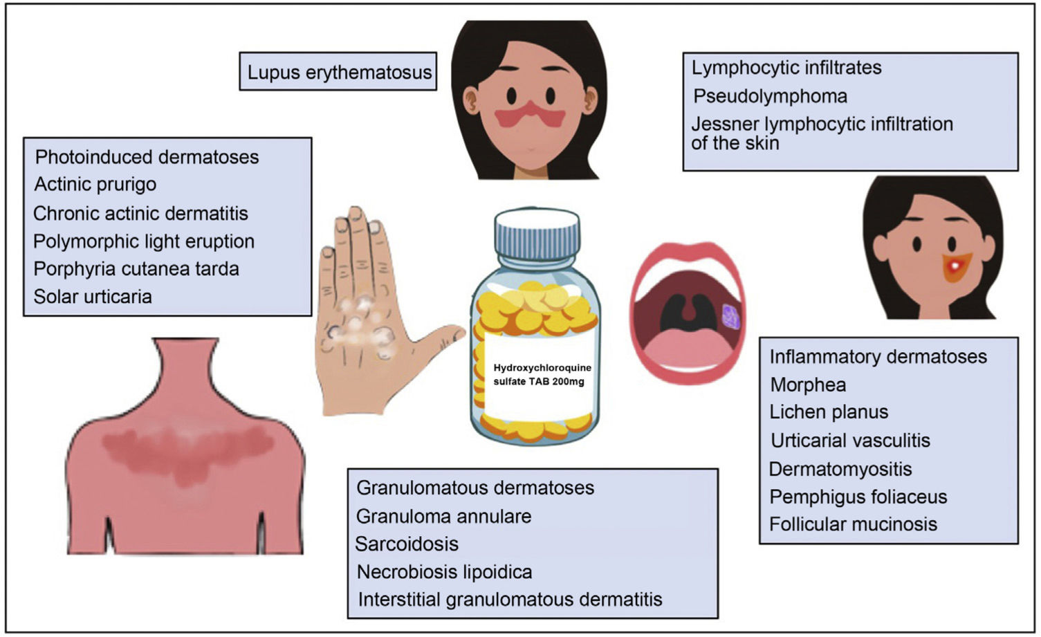hydroxychloroquine side effects