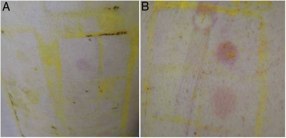 shellac chemotechnique