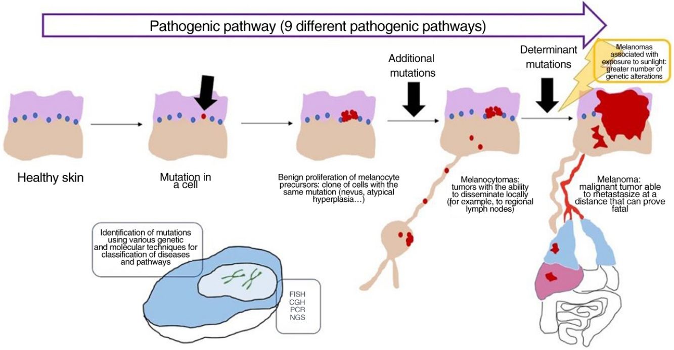 malignant tumors examples