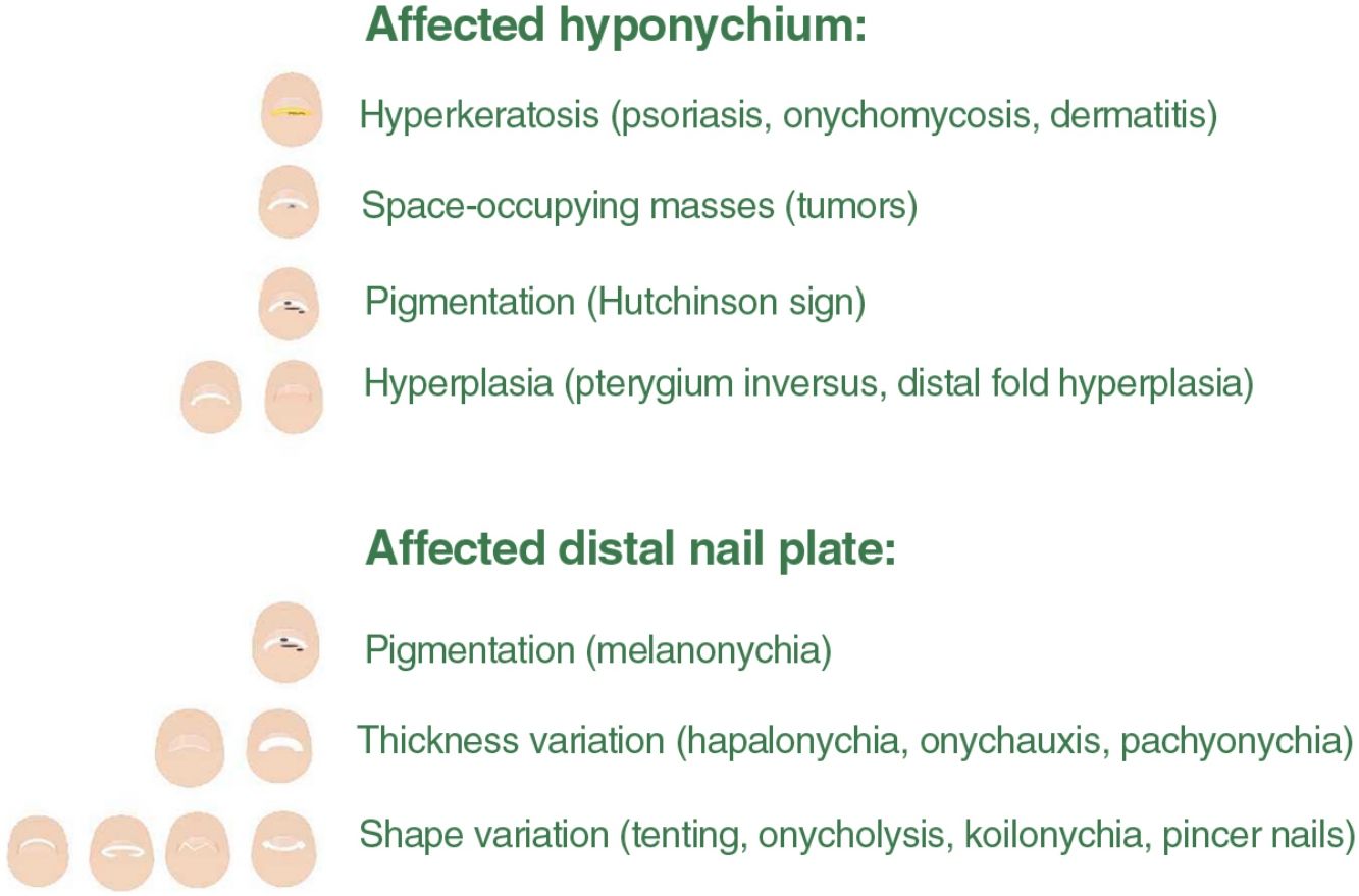 [Translated article] Frontal Examination of the Distal Nail Unit ...