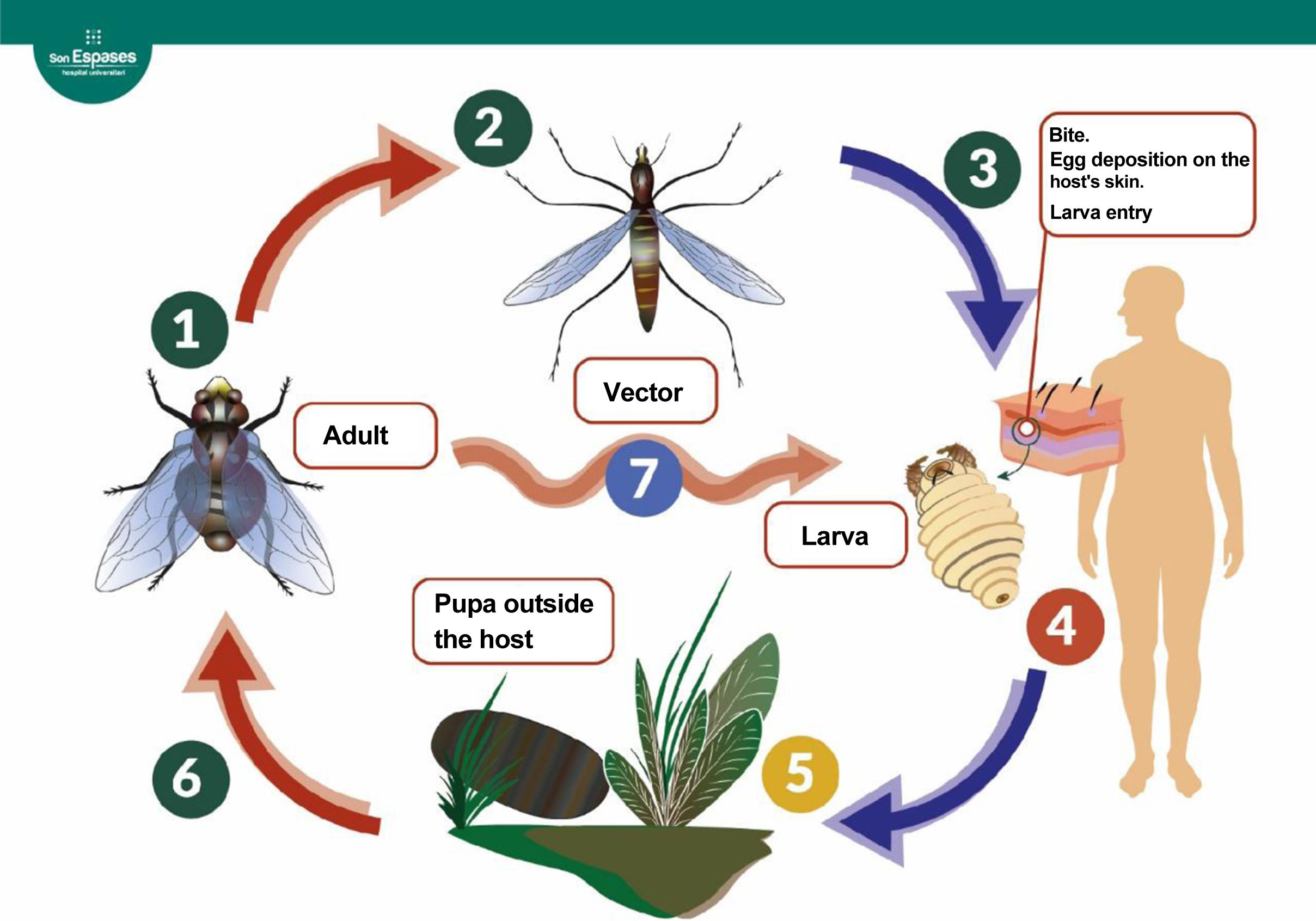 cutaneous myiasis