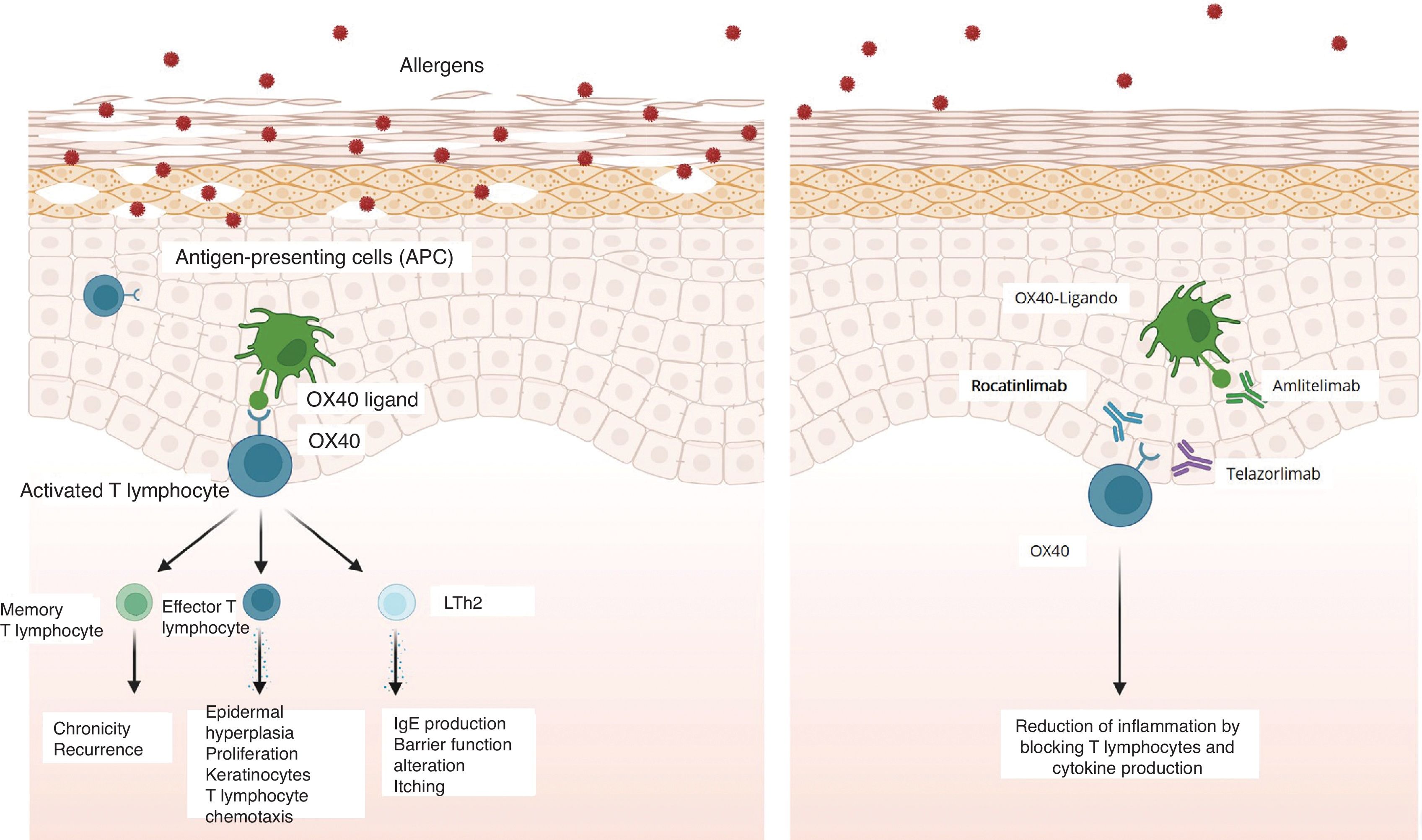 RF – OX40: A Promising Therapeutic Target in Moderate-to-severe Atopic ...