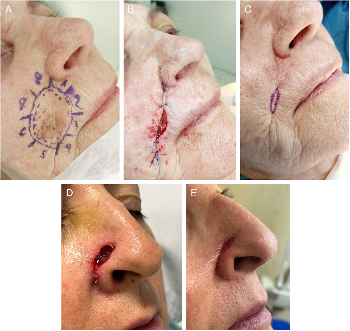 minor wound without intent