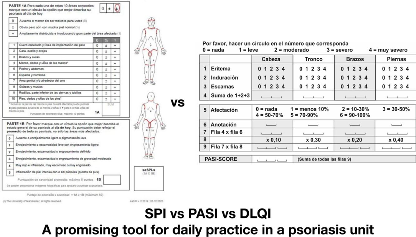 Application of the Simplified Psoriasis Index in the Routine Clinical ...
