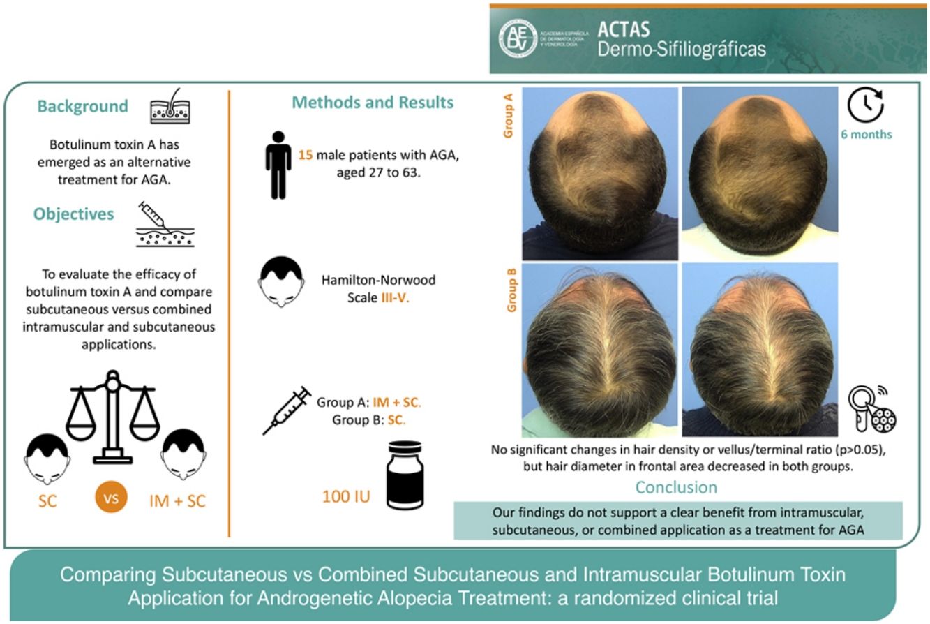 Subcutaneous Versus Combined Subcutaneous and Intramuscular Botulinum ...