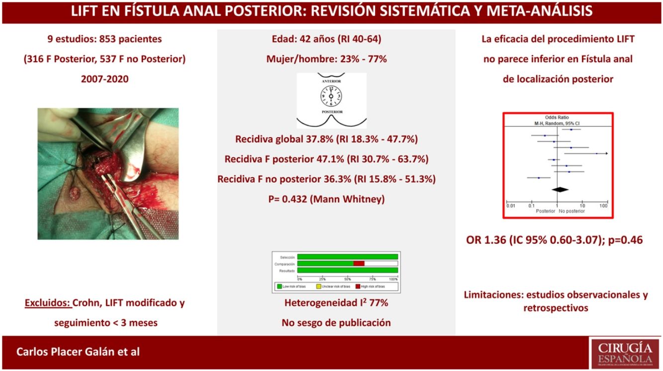 Procedimiento LIFT en fístulas anales de localización posterior. ¿Son ...