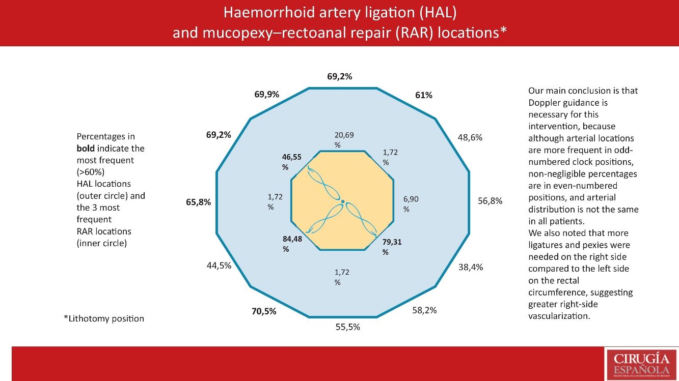 Haemorrhoidal artery distribution in patients with grade III and IV ...