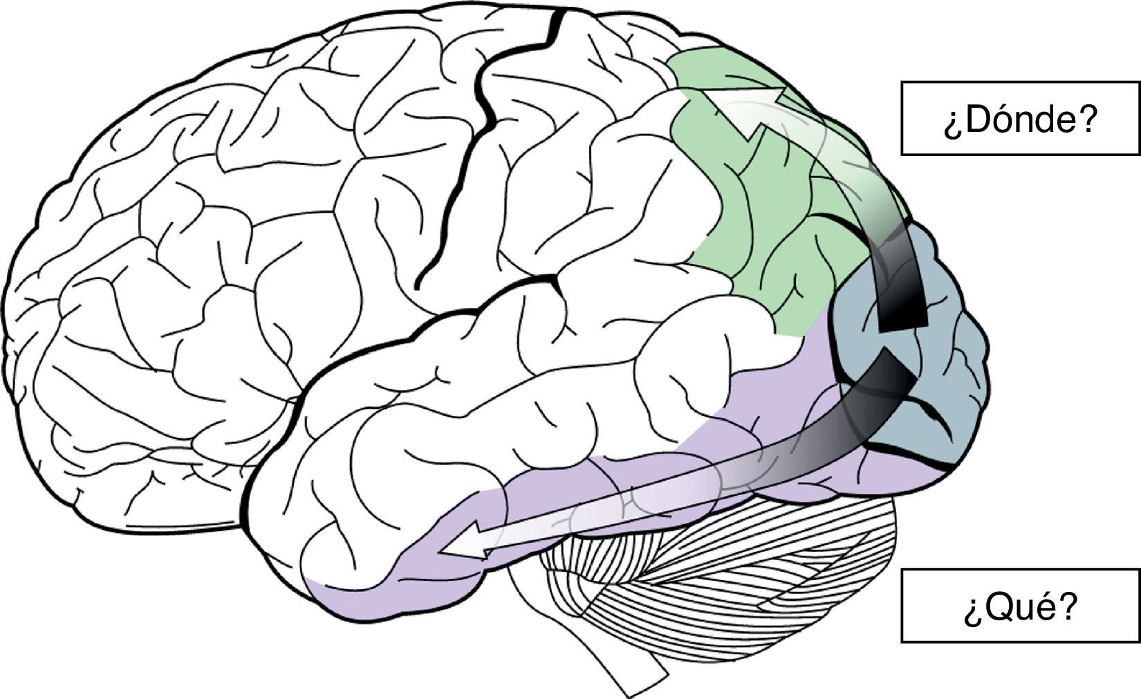 Agnosias visuales | Revista Clínica Española