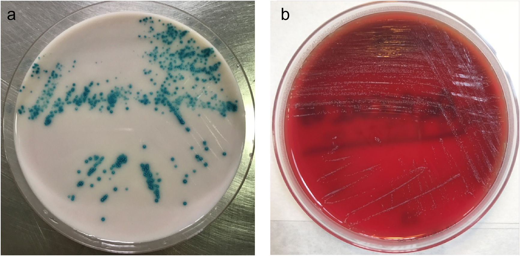 Infección urinaria por Aerococcus sanguinicola. Patógeno emergente ...