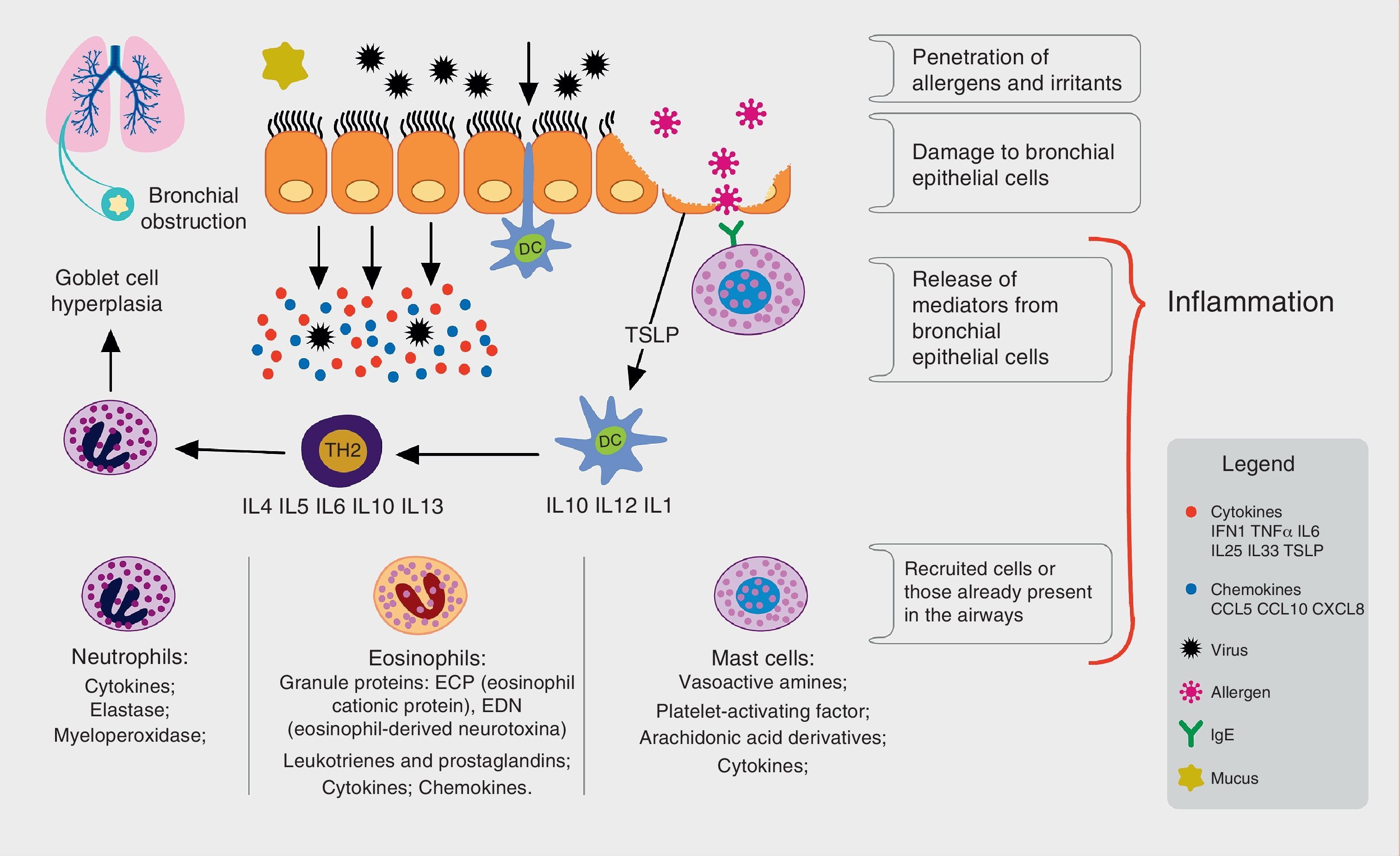 wheeze pathophysiology