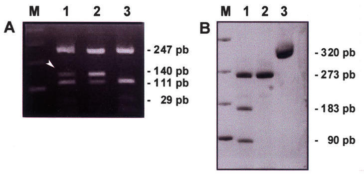 Importancia del polimorfismo 5569G/A del intrón 4 del gen HFE en el ...
