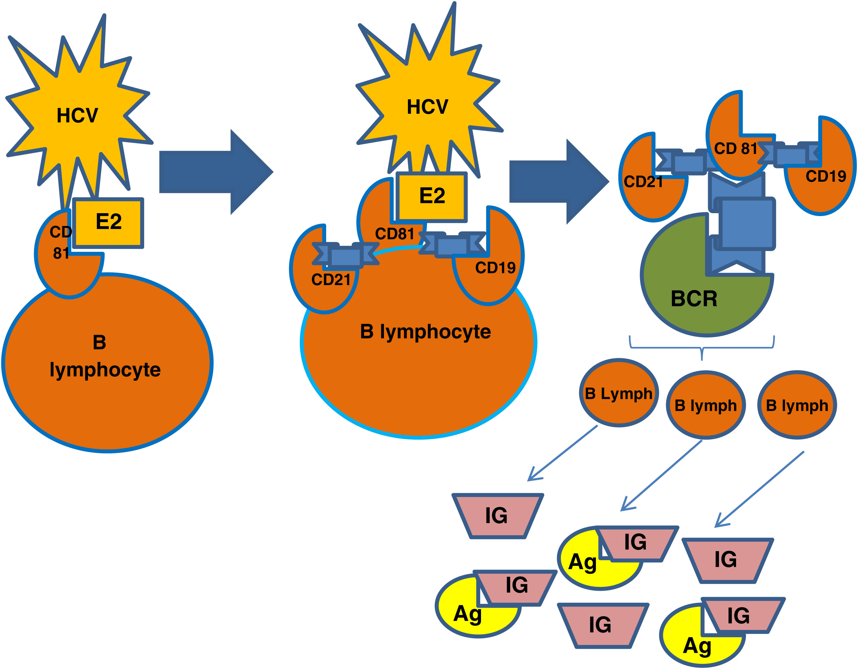 Extrahepatic manifestations of HCV where do we stand? | Medicina Clínica