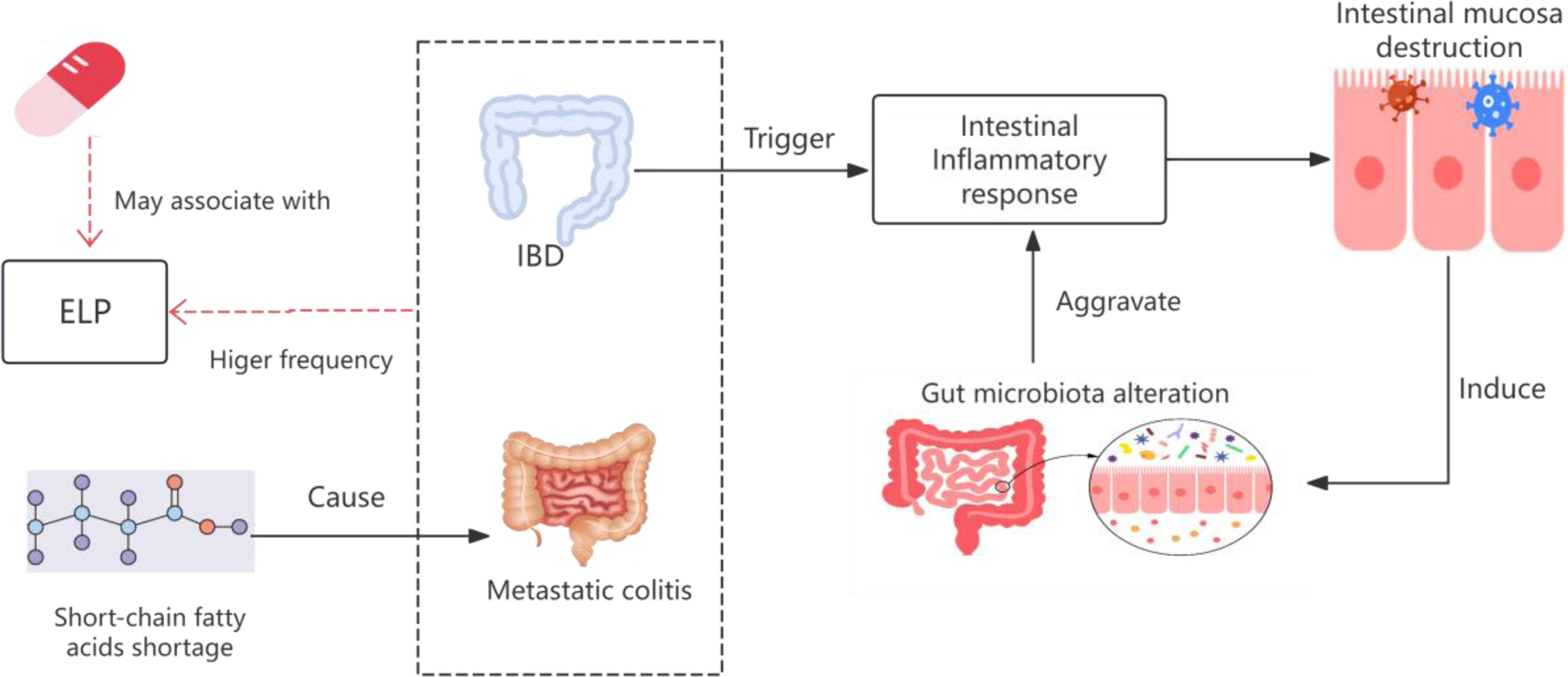 Enterocolic lymphocytic phlebitis: Clinical insights from a literature ...