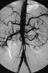 Angio-TC. Aplicaciones y protocolos específicos | Radiología