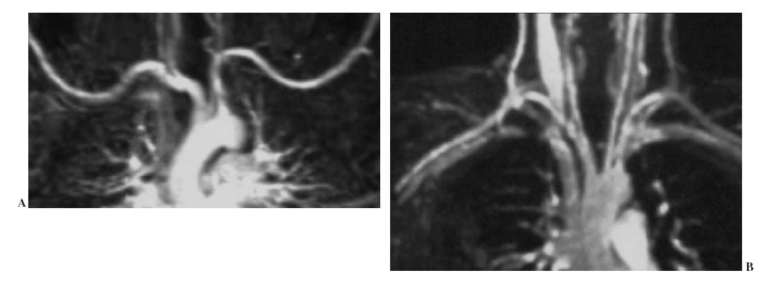 Angio-RM en el sistema osteomuscular | Radiología