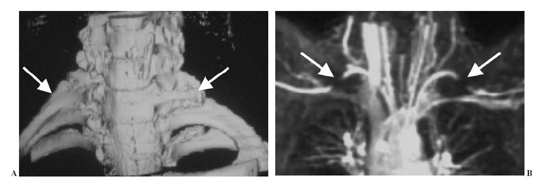 Angio-RM en el sistema osteomuscular | Radiología