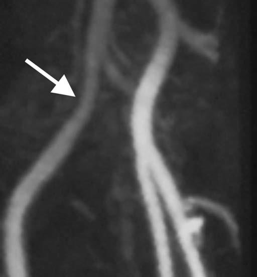 Angio-RM en el sistema osteomuscular | Radiología