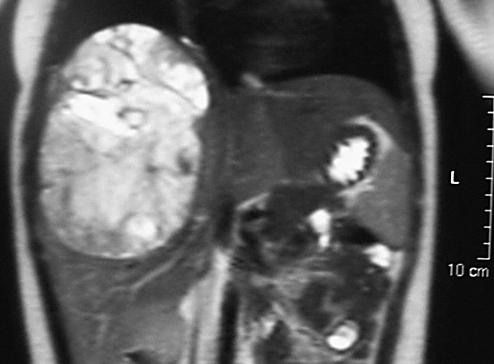 Caso en imagen:1 | Radiología