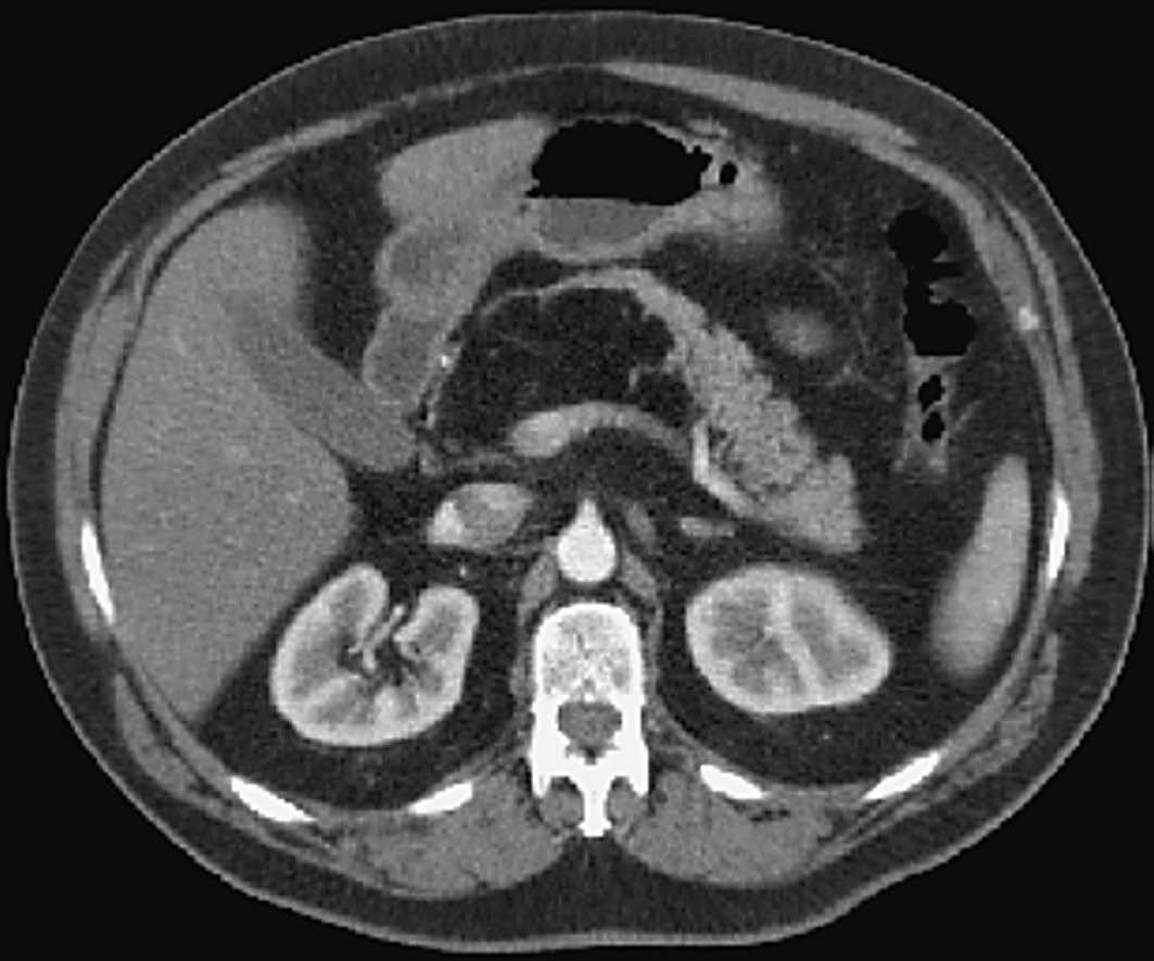Caso 1 | Radiología