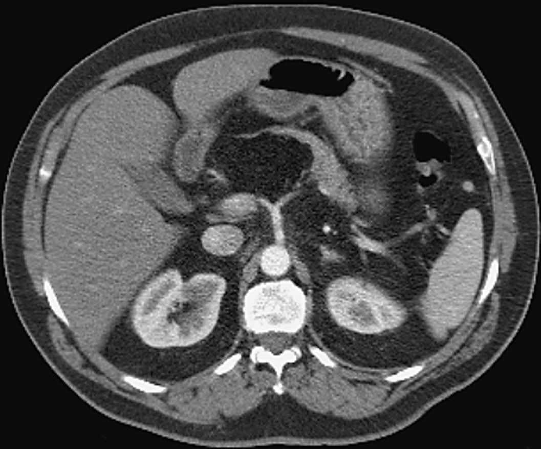 Caso 1 | Radiología