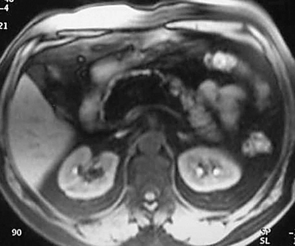 Caso 1 | Radiología
