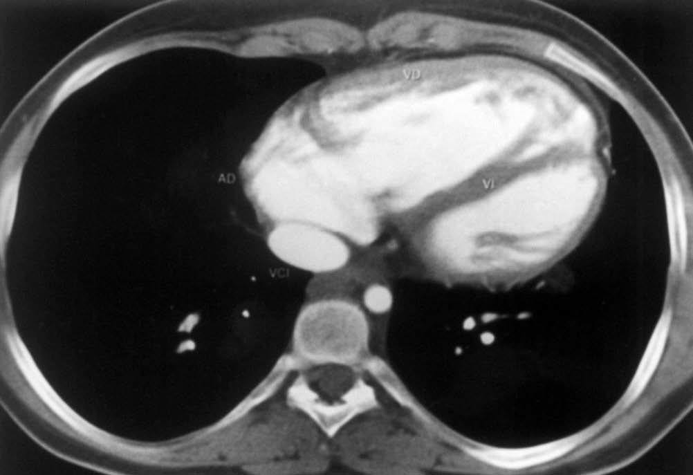 Caso 1 | Radiología