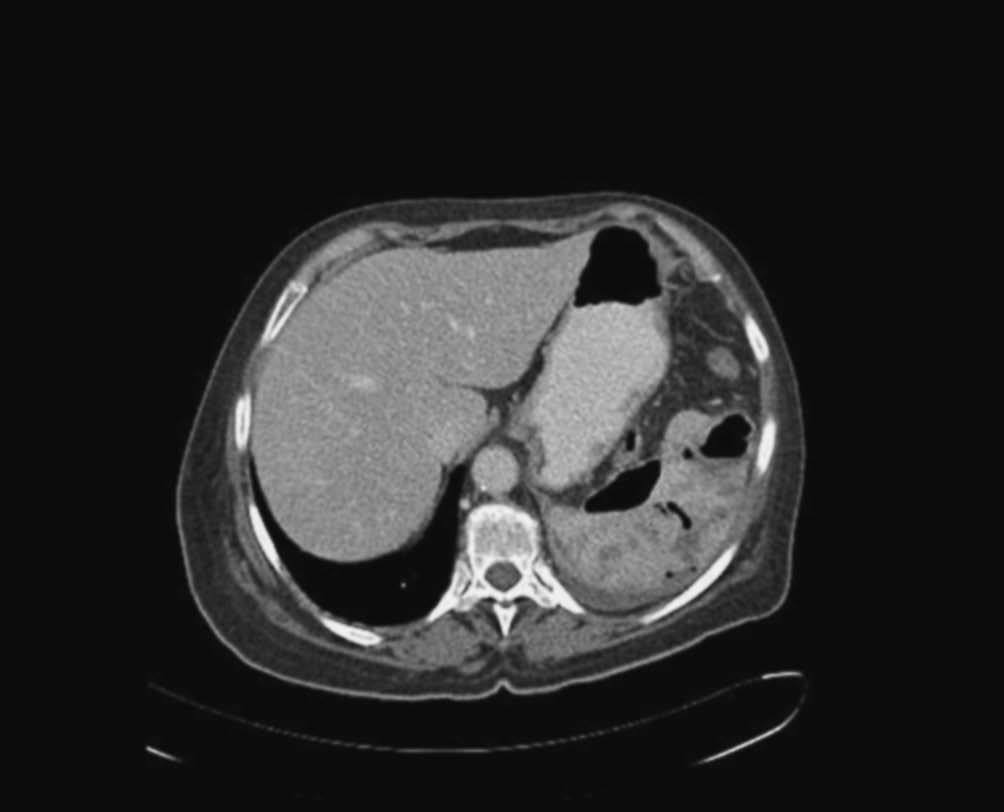 Caso 1 | Radiología