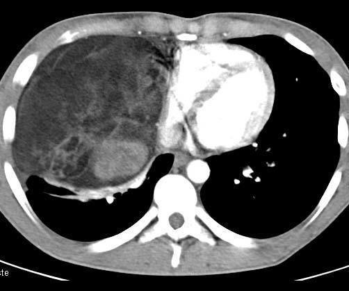 Caso en imagen:3 | Radiología