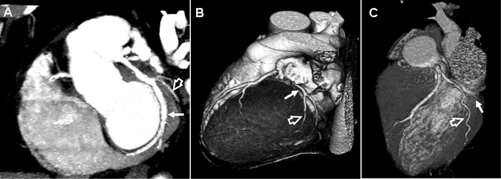Anatomía normal, variantes anatómicas y anomalías del origen y trayecto ...