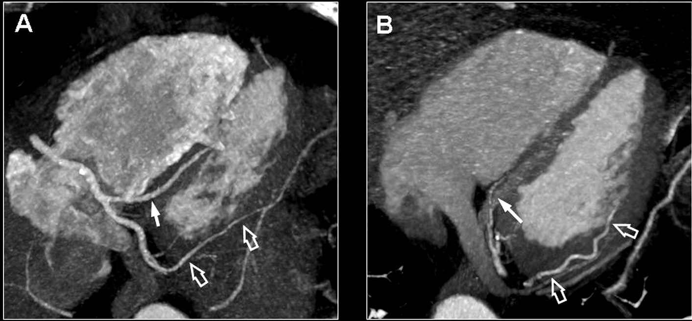 Anatomía normal, variantes anatómicas y anomalías del origen y trayecto ...