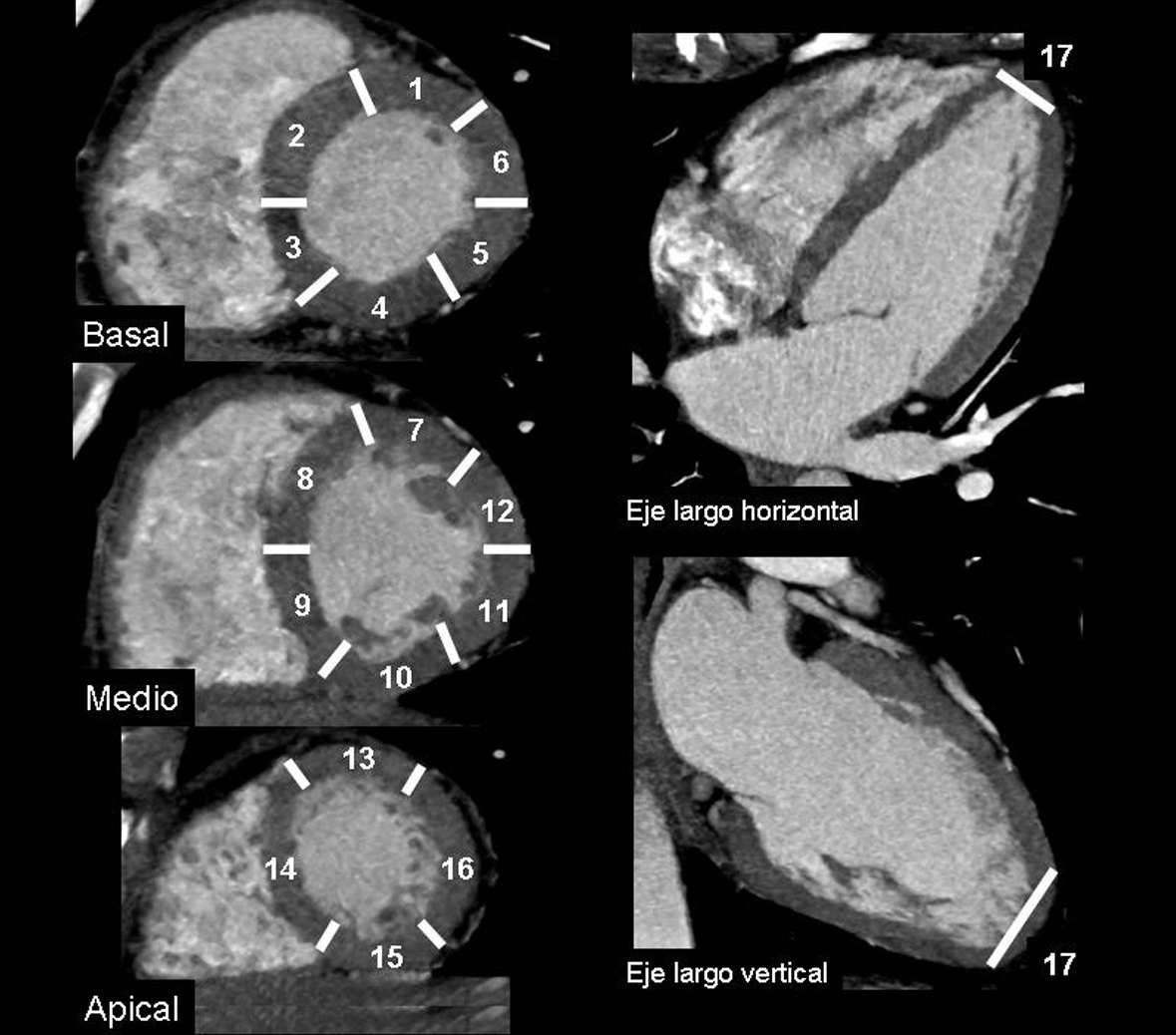 Anatomía normal, variantes anatómicas y anomalías del origen y trayecto ...