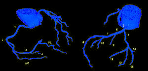 Anatomía normal, variantes anatómicas y anomalías del origen y trayecto ...