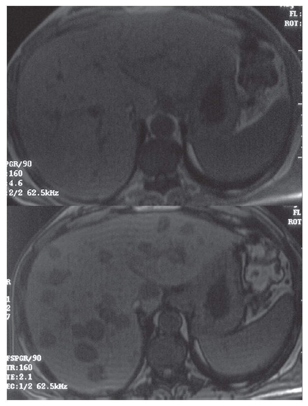 Caso 5* | Radiología