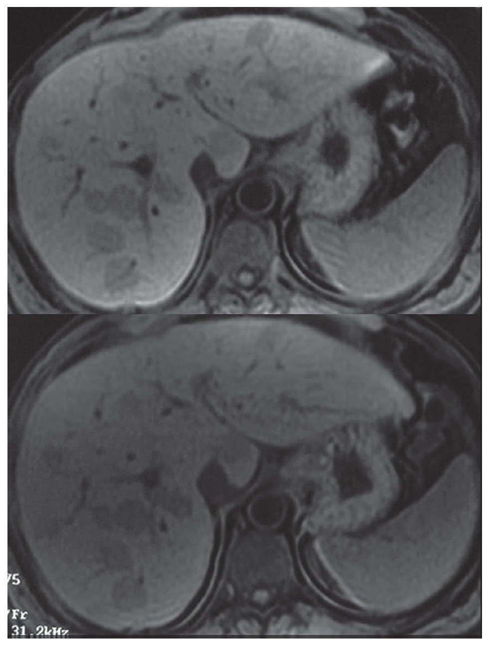 Caso 5* | Radiología