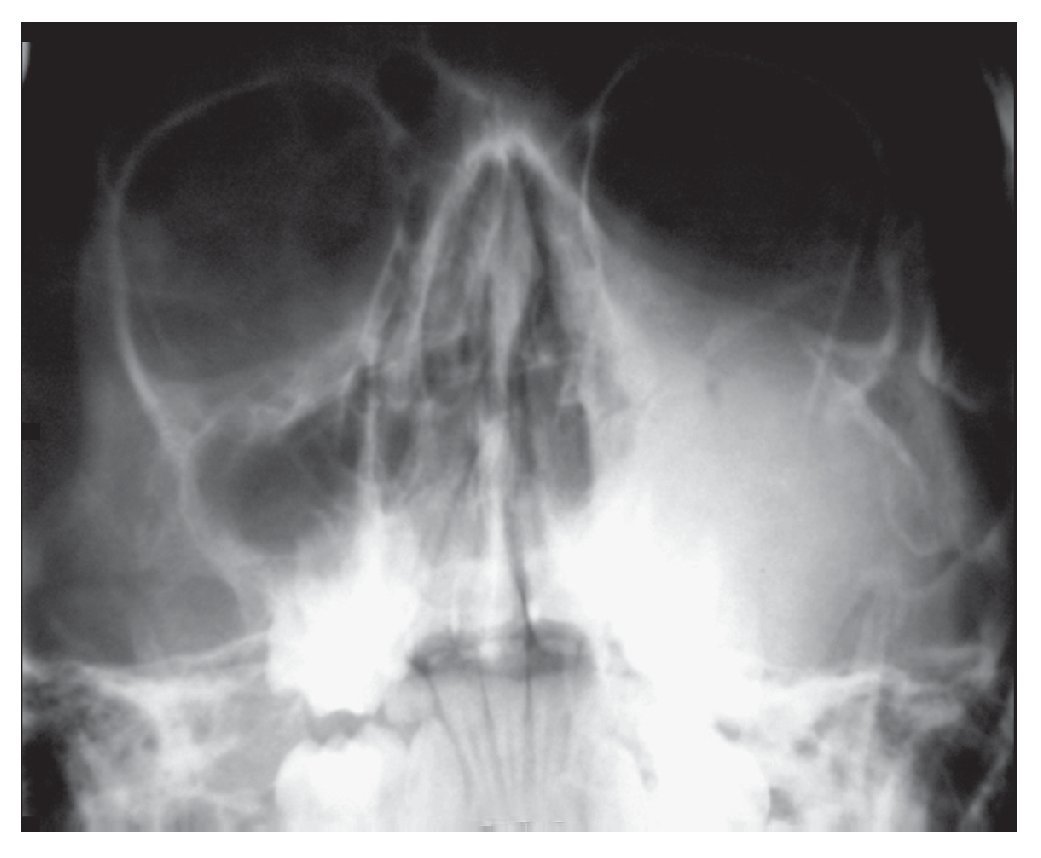 Caso 6* | Radiología