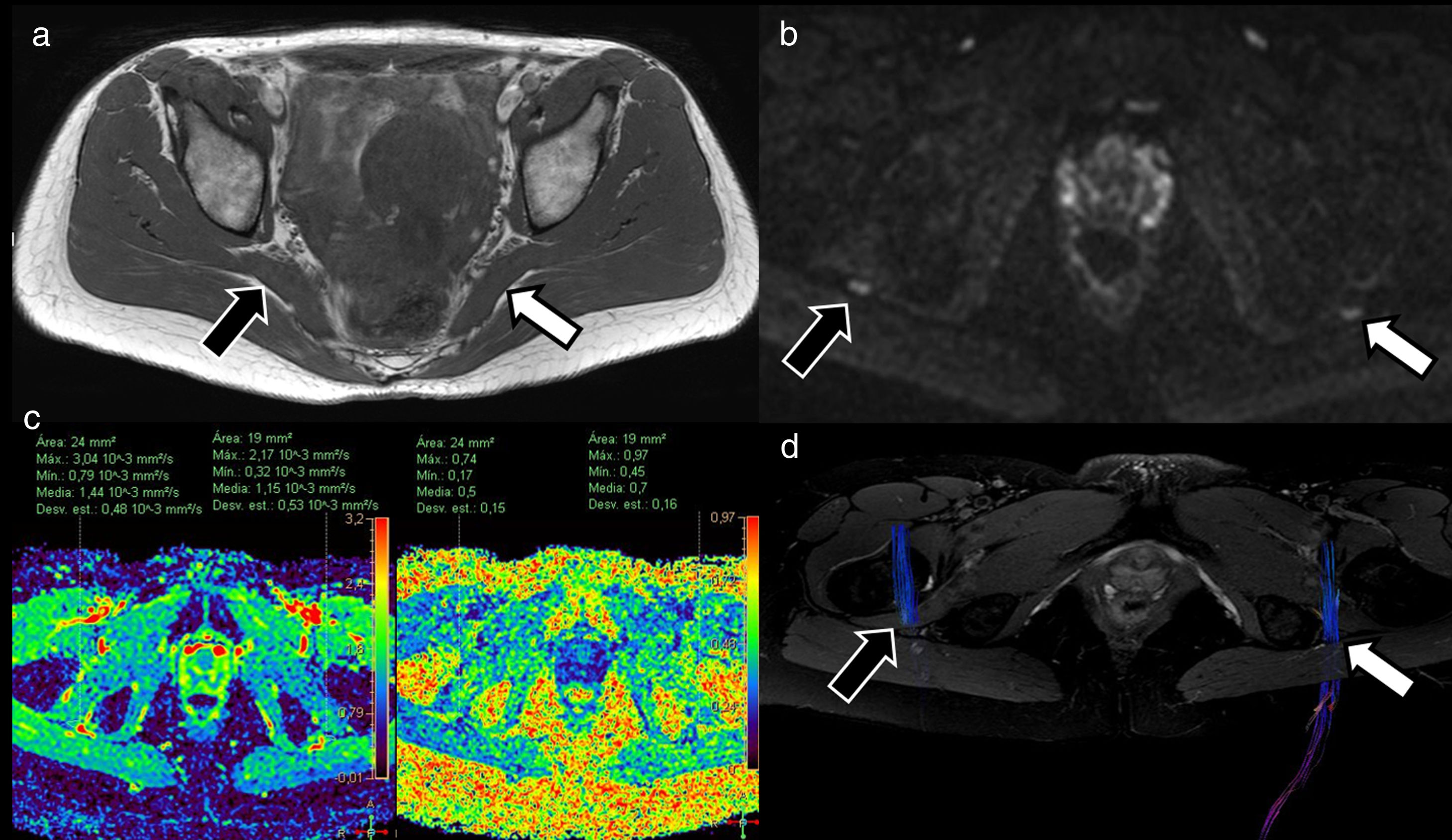 Actualización en la valoración de los nervios periféricos mediante ...