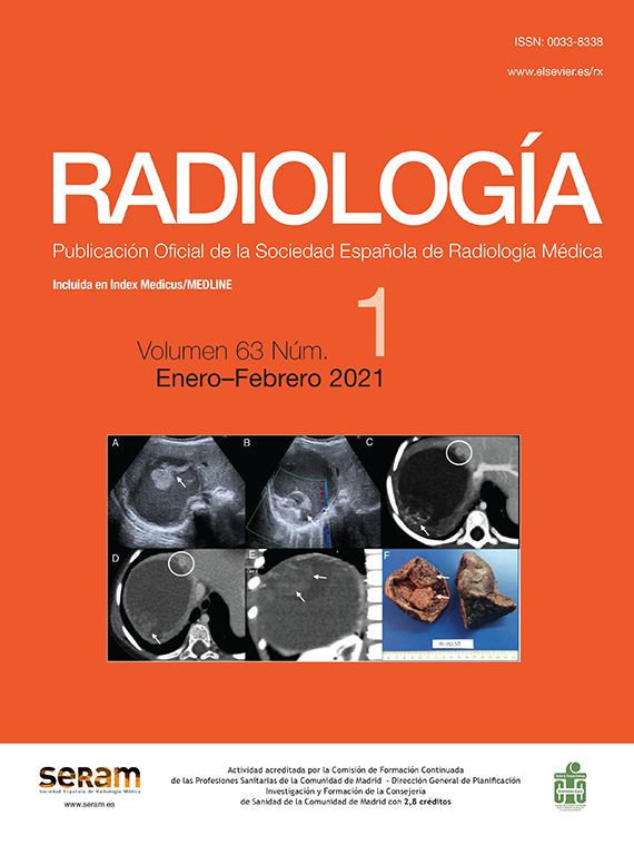 Enfermería Intensiva | Enfermería Intensiva