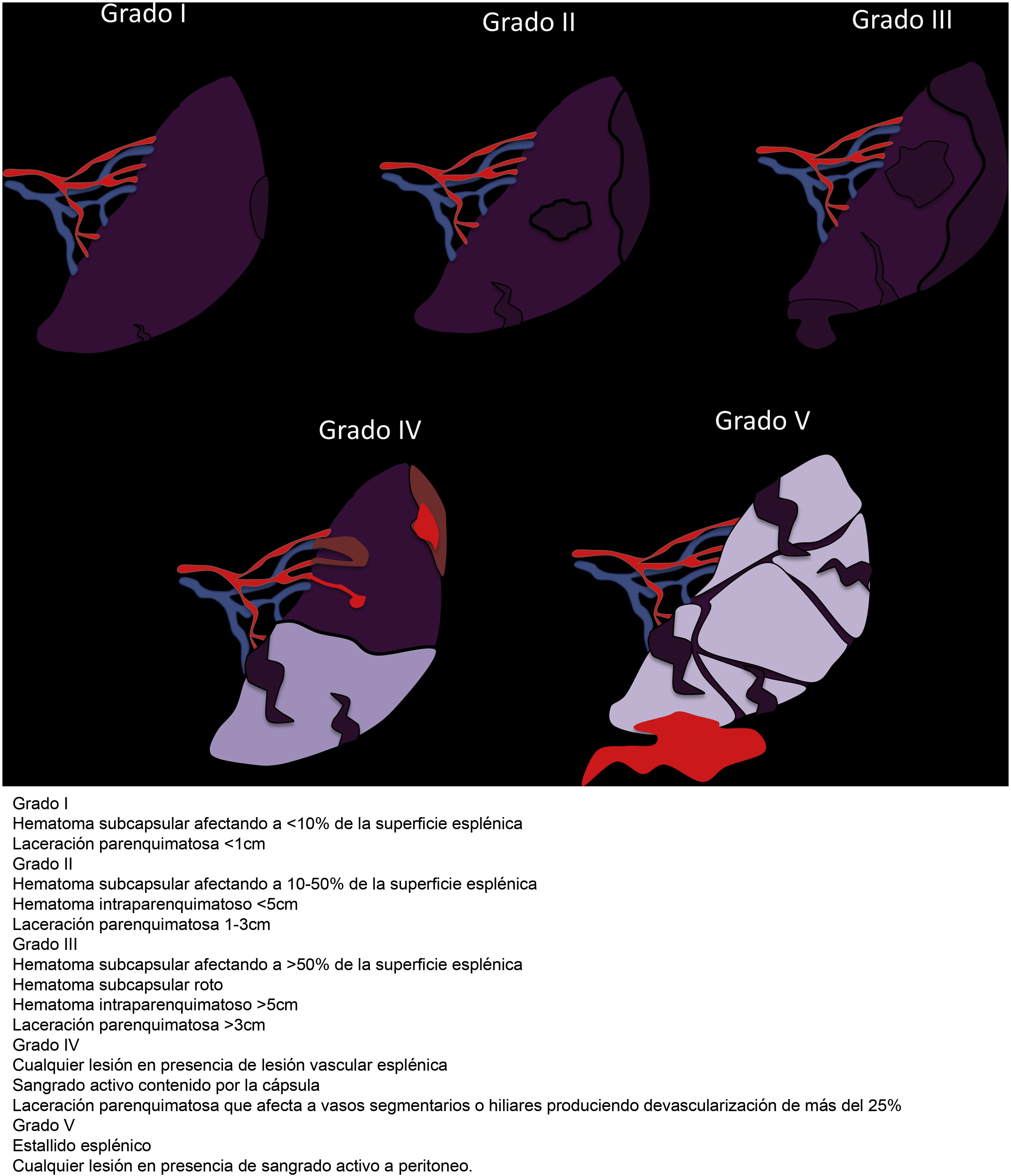 Traumatismo abdominal | Radiología