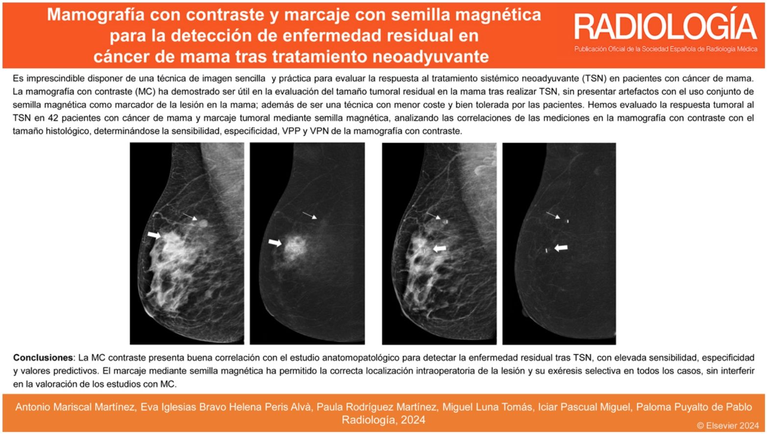 Mamografía con contraste y marcaje con semilla magnética para la ...