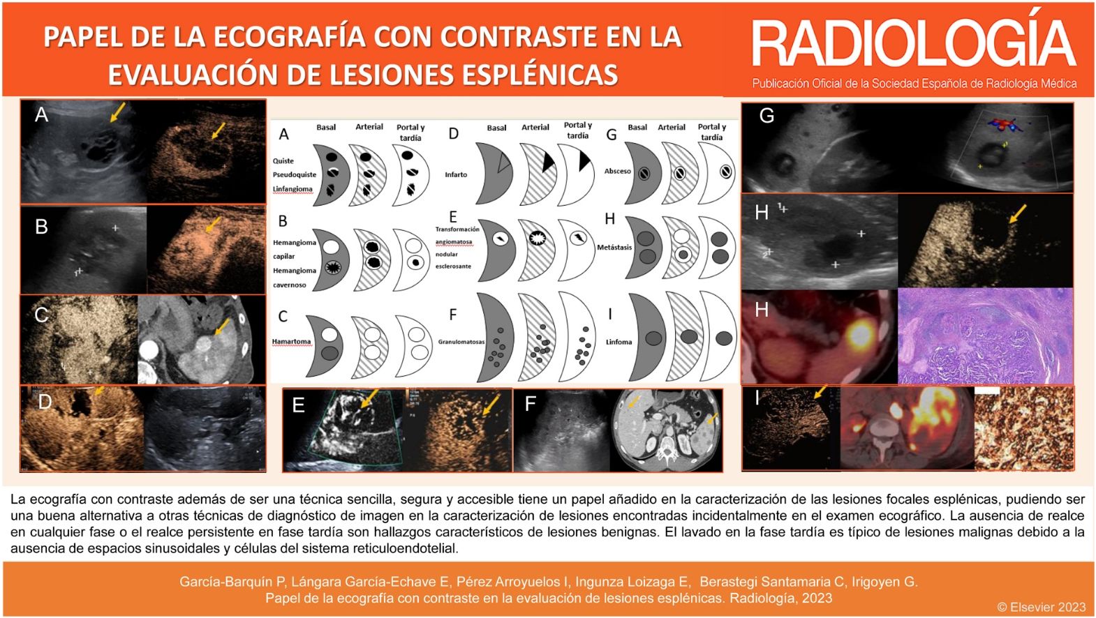 Papel de la ecografía con contraste en la evaluación de lesiones ...