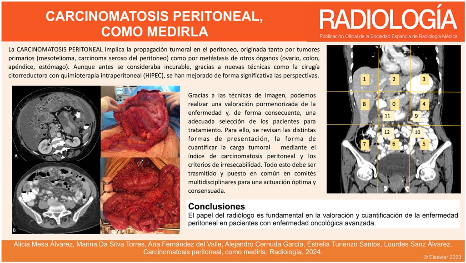 Carcinomatosis peritoneal, como medirla | Radiología
