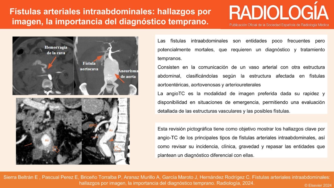 Fístulas arteriales intraabdominales: hallazgos por imagen, la ...
