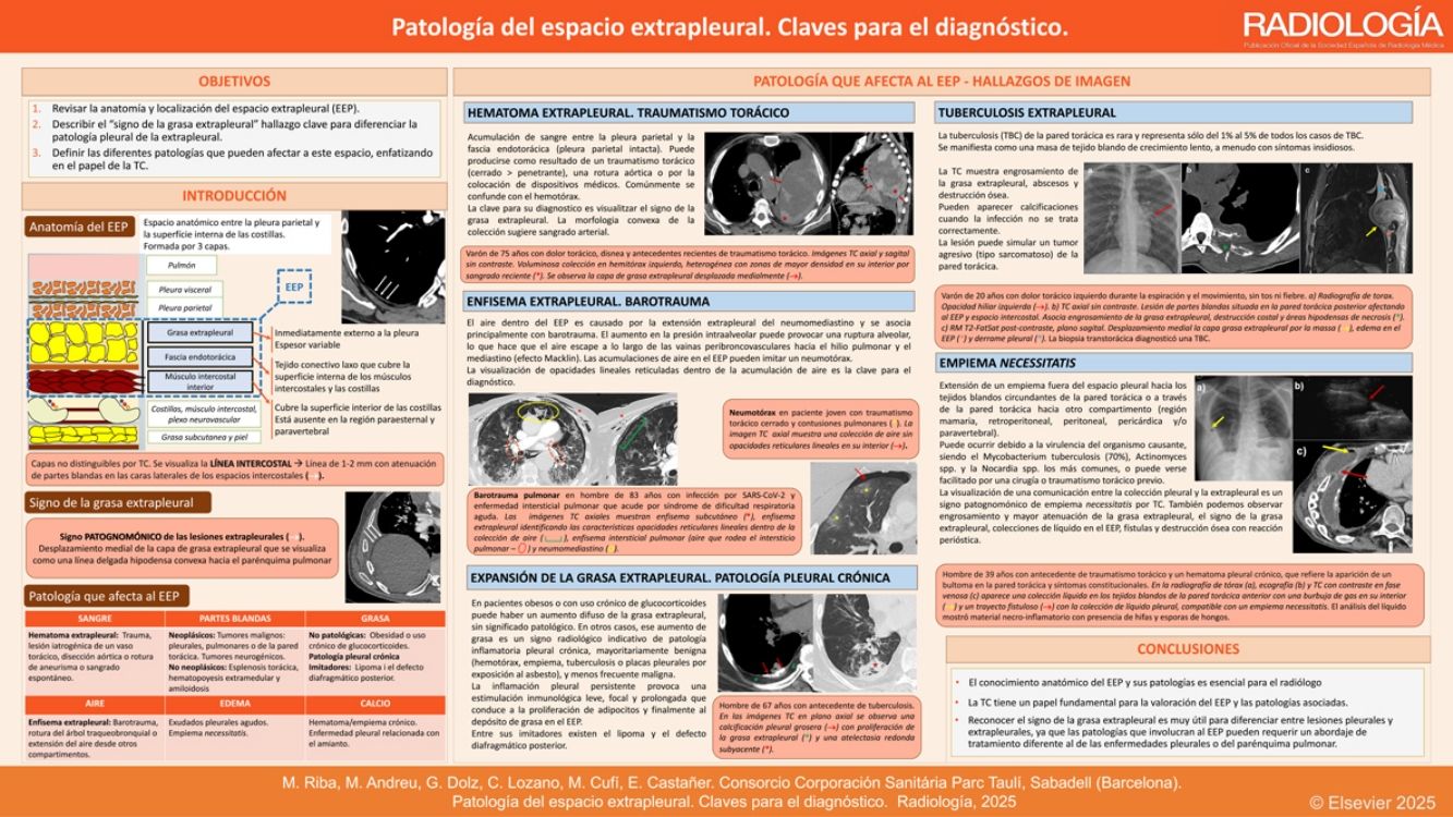 Patología del espacio extrapleural. Claves para el diagnóstico | Radiología