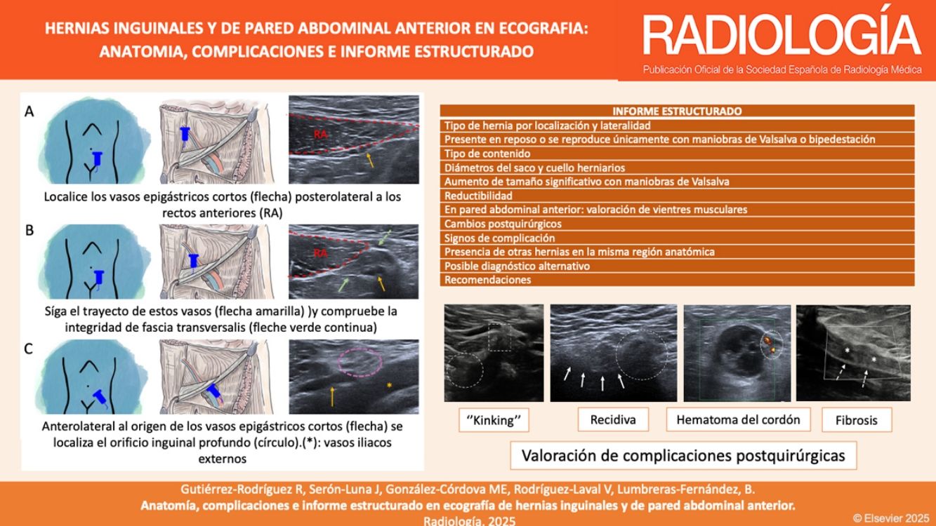 Anatomía, complicaciones e informe estructurado en ecografía de hernias ...