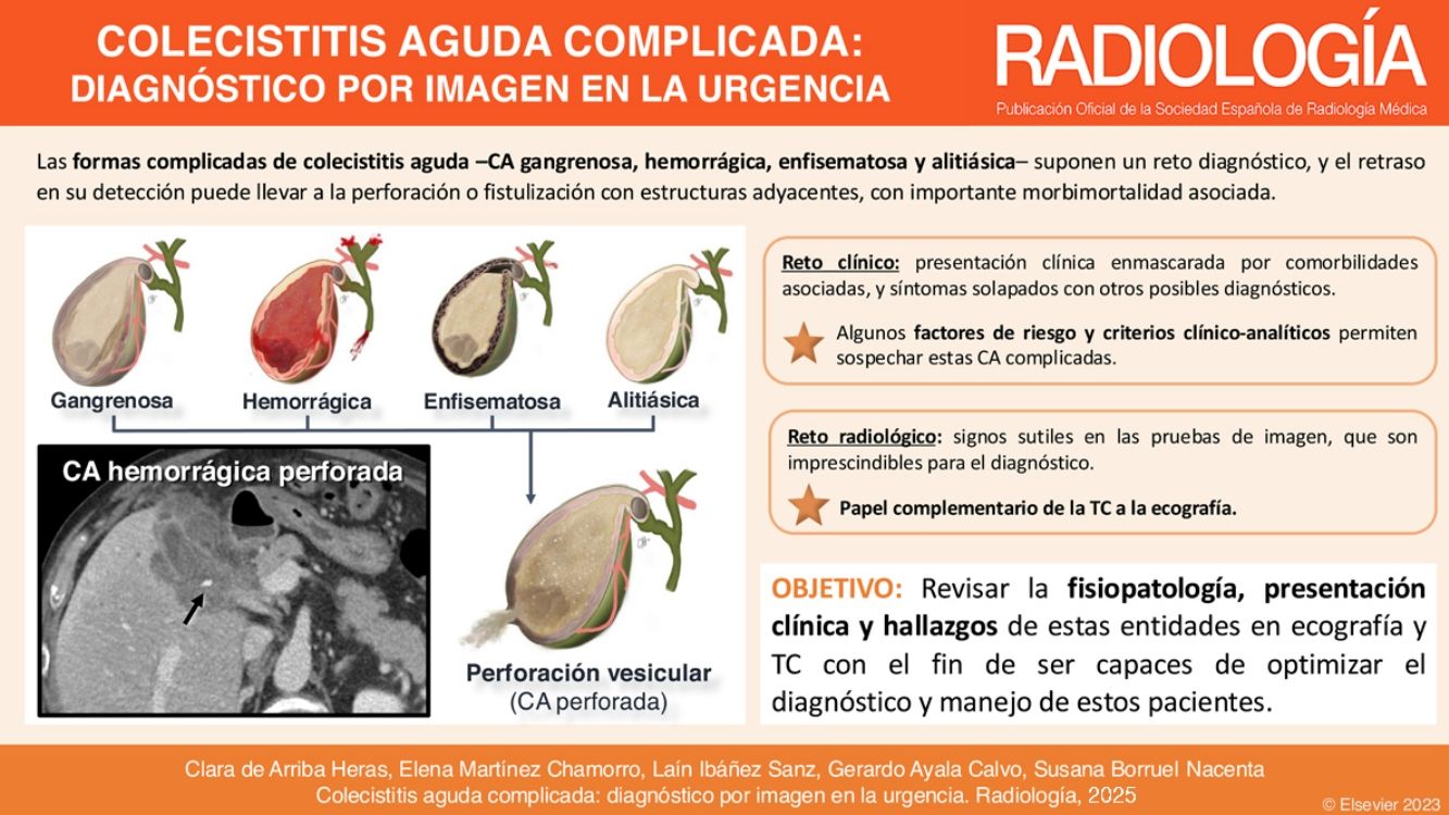 Colecistitis aguda complicada: diagnóstico por imagen en la urgencia ...