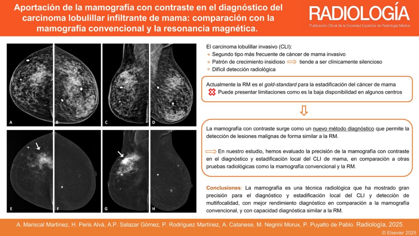 Aportación de la mamografía con contraste en el diagnóstico y ...