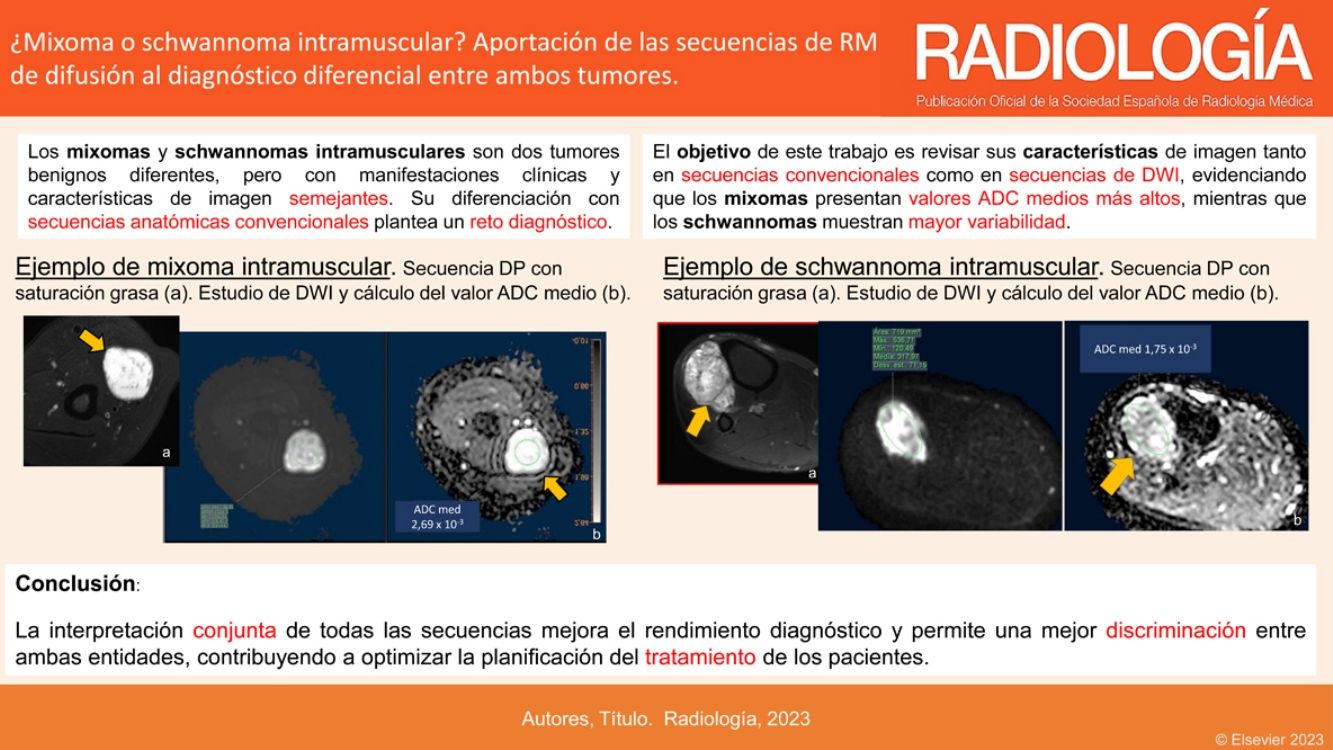 ¿Mixoma o schwannoma intramuscular? Aportación de las secuencias de ...